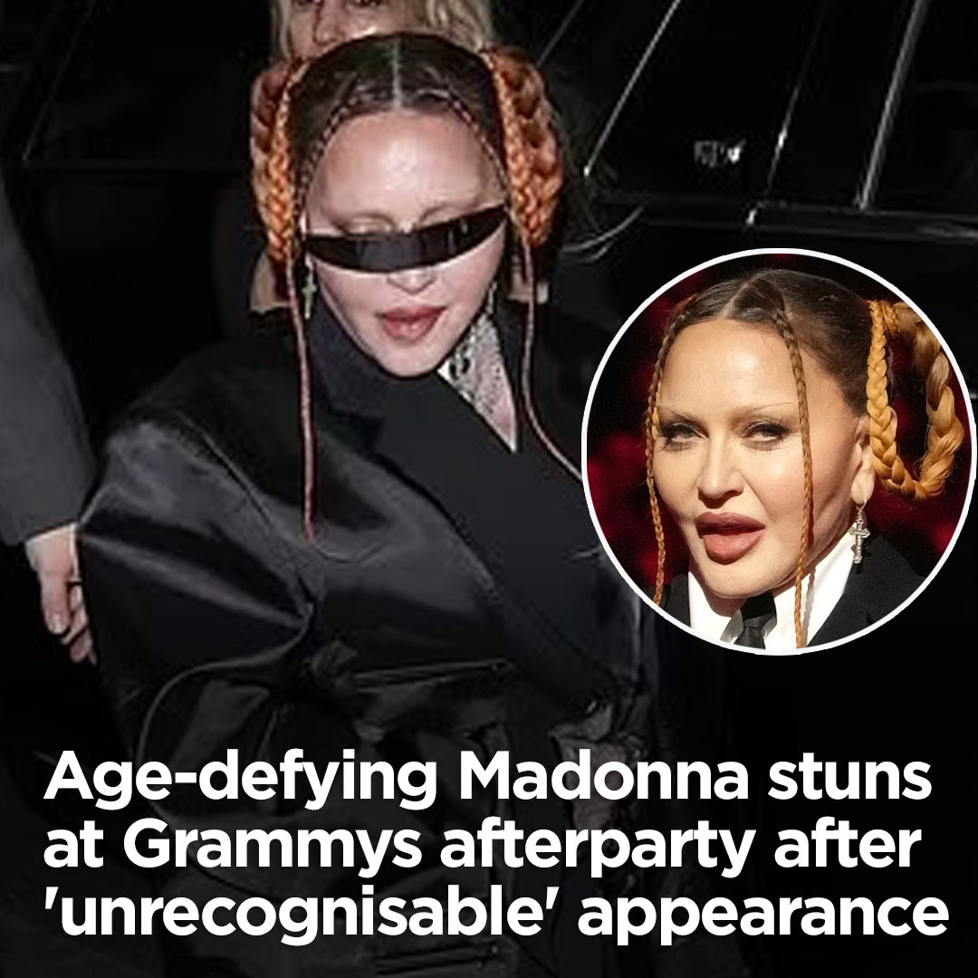 Age-defying? LOL That's the look of a surgically modified face.